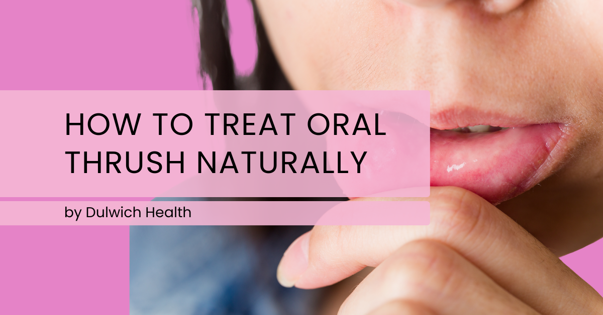 How to Treat Oral Thrush Naturally – Dulwich Health